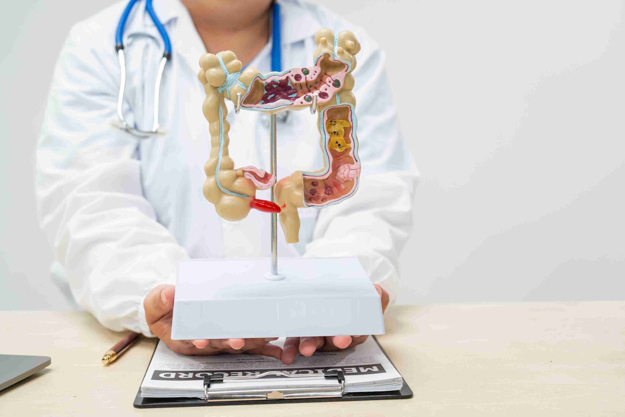 Are Colon Cancer Symptoms Always Progressive?
